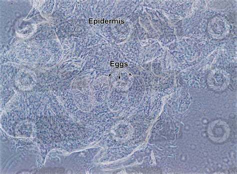 Sarcoptes Scabiei Itch Mite Sarcoptic Mange Eggs 100x Arachnida