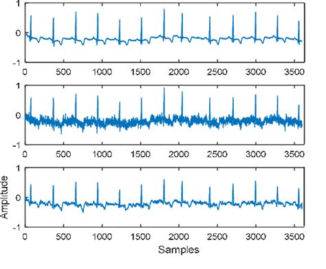 figure 1 from real time ecg signal denoising using the adtf algorithm for embedded