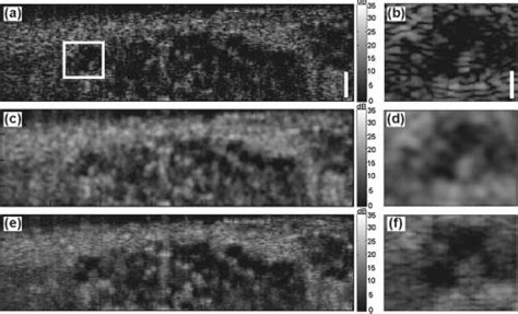 Speckle Reduction In Optical Coherence Tomography Images Using Tissue Viscoelasticity Obel