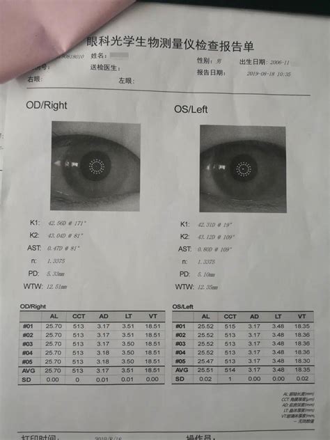 案例豪雅新乐学镜片控制近视度数增长的案例分享 搜狐大视野 搜狐新闻