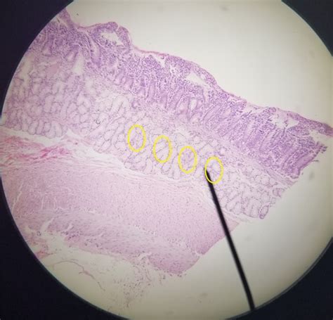 Duodenum Flashcards Quizlet
