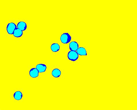 original image from the all idb1 database and final segmentation
