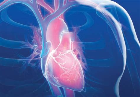 Endovascular Repair Of Complex Aortic Aneurysms Mayo Clinic