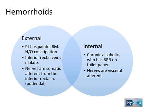 Internal Vs External Hemorrhoids