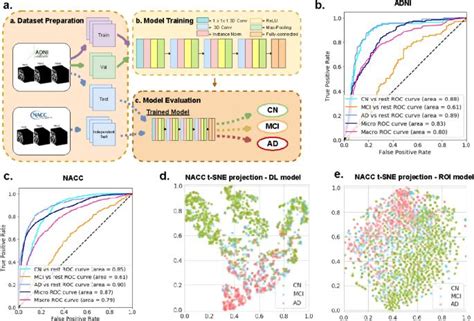 Generalizable Deep Learning Model For Early Alzheimers Disease