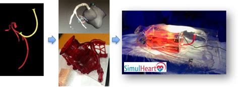 Patient Specific Simulation 3d Cardiosolutions