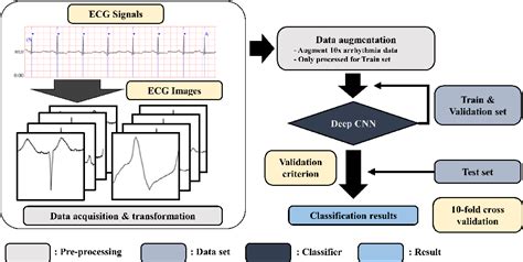 alternatives and detailed information of ecg arrhythmia classification gitplanet