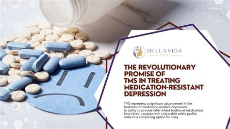 The Revolutionary Promise Of Tms In Treating Medication Resistant