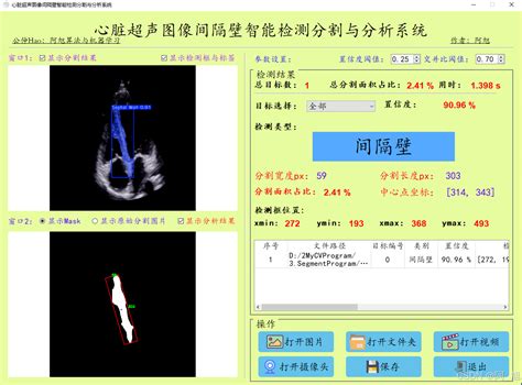 基于yolo11深度学习的心脏超声图像间隔壁检测分割与分析系统【python源码pyqt5界面数据集训练代码】深度学习实战、目标分割