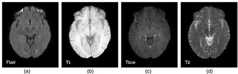 Samples From The Brats 2018 Dataset Flair T1 T1‐ce T2 From Left To Download Scientific