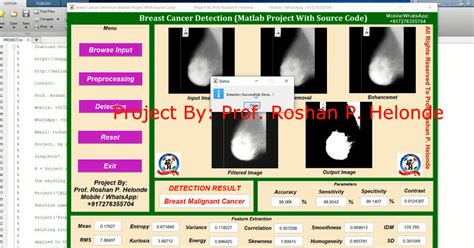 Breast Cancer Classification Using Cnn Convolutional Neural Network