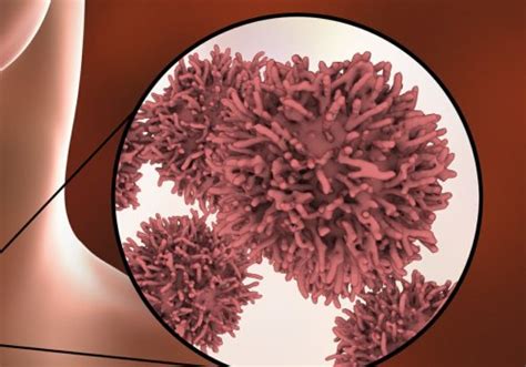 Why Does The Thyroid Gland Move During Swallowing