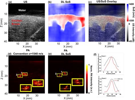 Evaluation Of Deep Learning Dl Based Speed Of Sound Sos