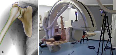 5 A 3d To 2d Shape Matching Technique Image From Cck 14 Used Download Scientific Diagram