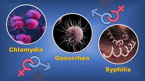 STD Testing Essentials What You Need To Know