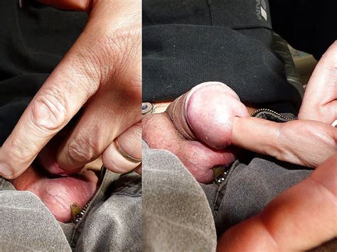 Fingers Insertions Hand In Cock 31 Pics Xhamster