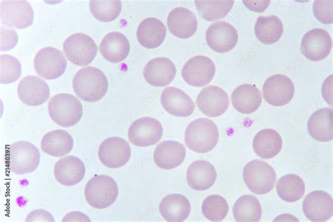 Platelets Under Microscope