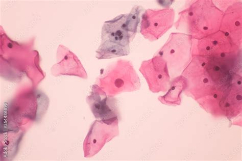 What Are Squamous Epithelial Cells In Cervix At Judy Robeson Blog