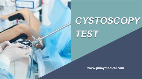 Cystoscopy Test Price In The Philippines 2025 — Pinoymedical
