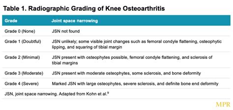 Osteoarthritis Mpr