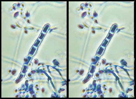 Trichophyton Rubrum Var Rodhaini In 3d 2d To 3d Conversi… Flickr