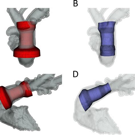 Demonstration Of Conforming Virtual Device To The Right Ventricular Download Scientific Diagram