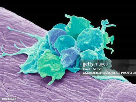Scanning Electron Microscope Photos And Premium High Res Pictures Getty Images