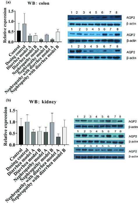 Western Blot Analysis Showing Aquaporin 2 Aqp2 Protein Expression In