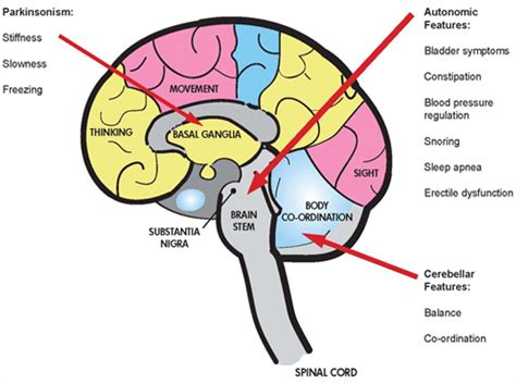 Alternative Medicines For Multiple System Atrophy Msa