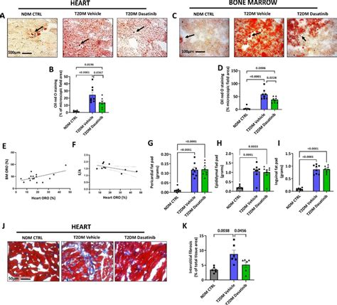Prolonged Dasatinib Treatment Reduces Lipid Content In The Heart And