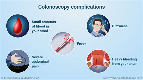 Slide Show What Happens During And After A Colonoscopy