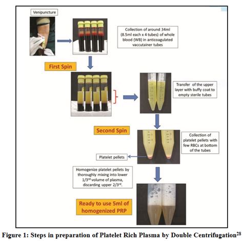 Journey Of Platelet Concentrates A Review Biomedical And
