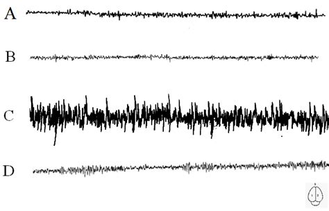 Electroencephalographic Eeg Recordings A Control Model Download Scientific Diagram