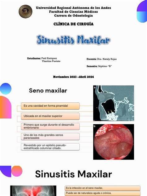 Sinusitis Maxilar Pdf Especialidades Medicas Medicina Clinica