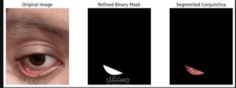 Conjunctiva Segmentation مستقل