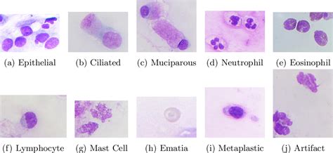 Figure 1 From A Nasal Cytology Dataset For Object Detection And Deep Learning Semantic Scholar