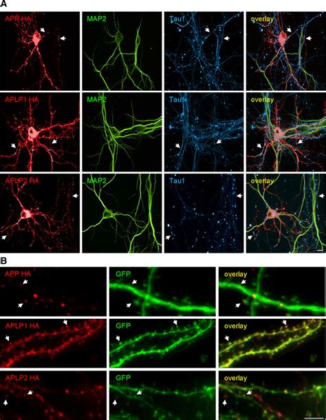 Analysis Of Axonal And Dendritic Localization Of Heterologously