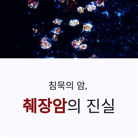 🧬초기 증상으로 알아보는 췌장암의 모든 것 생존율 높이는 예방법과 체크리스트