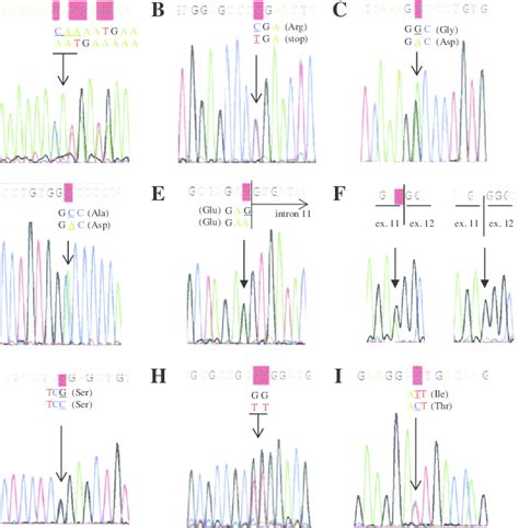 Sequence Electropherograms Showing The Following Mutations Download Scientific Diagram
