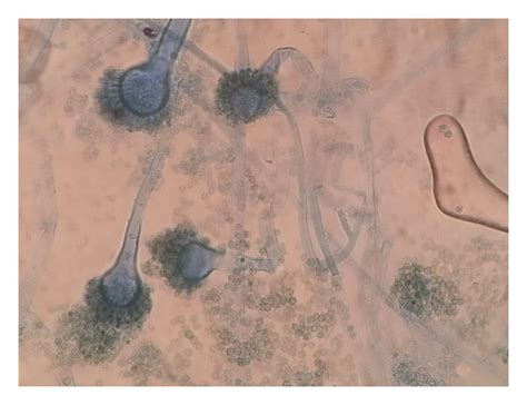 Confirmation Of Aspergillus Niger With The Specific Phenotypic Download Scientific Diagram