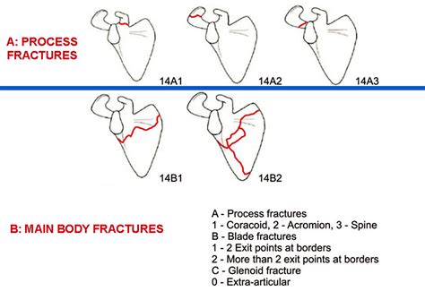 Sports Performance Bulletin Injuries And Health Scapular Fracture An