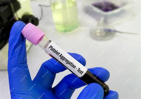 Premium Photo Platelet Aggregation Test Diagnosis For Platelet