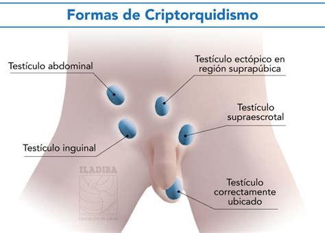 Criptorquidea Mind Map