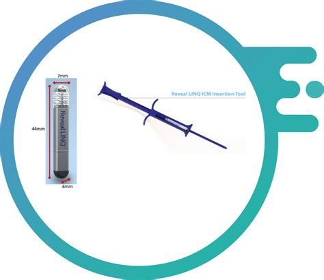 Loop Recorder Implantation In Chennai Dr Karthigesan Clinic