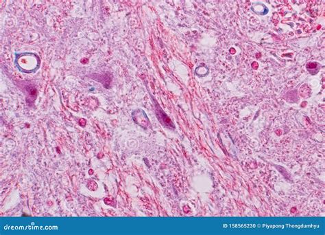 Nerve Human Under The Microscope Royalty Free Stock Image