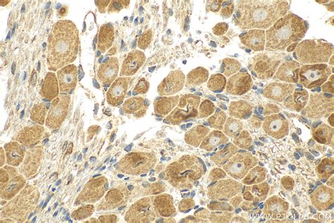 Mrgprx3 Antibody 17946 1 Ap Proteintech
