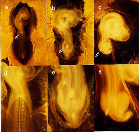 Photomicrographs Of Amnion Formation In Intact Chick Embryos At Stage