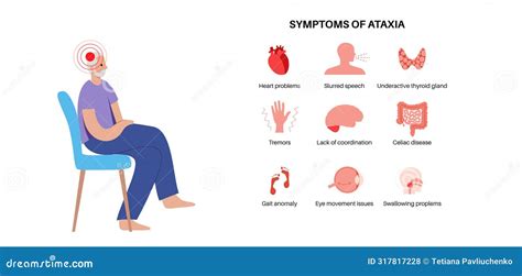 Ataxia Cerebellar Disorder Stock Vector Illustration Of Condition 317817228