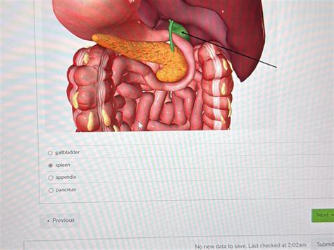Identify The Organ In The Image Studyx Identify The Organ In The Image Studyx