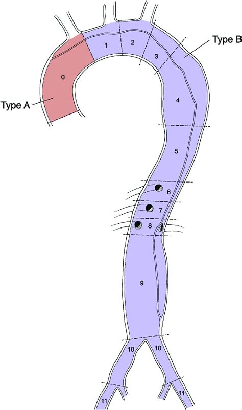 Society For Vascular Surgerysociety Of Thoracic Surgeons Svssts Download Scientific Diagram